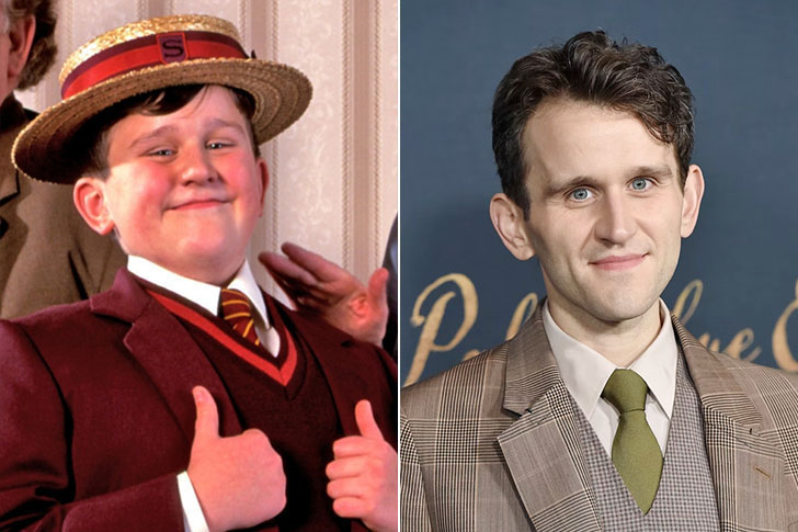 Magic After Hogwarts Where Are Harry Potter Stars Now Weight Loss