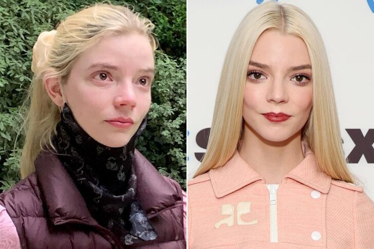 No Make-up? No Problem! Celebrities Who Aren't Afraid To Show Off Their ...