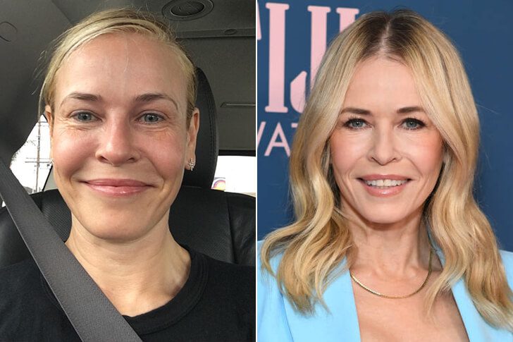 No Make-up? No Problem! Celebrities Who Aren't Afraid To Show Off Their ...