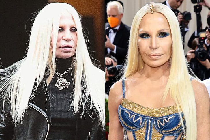 No Make-up? No Problem! Celebrities Who Aren't Afraid To Show Off Their ...